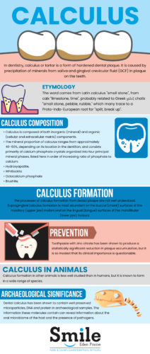 General Dentistry Concepts : Calculus | Smile Eden Prairie