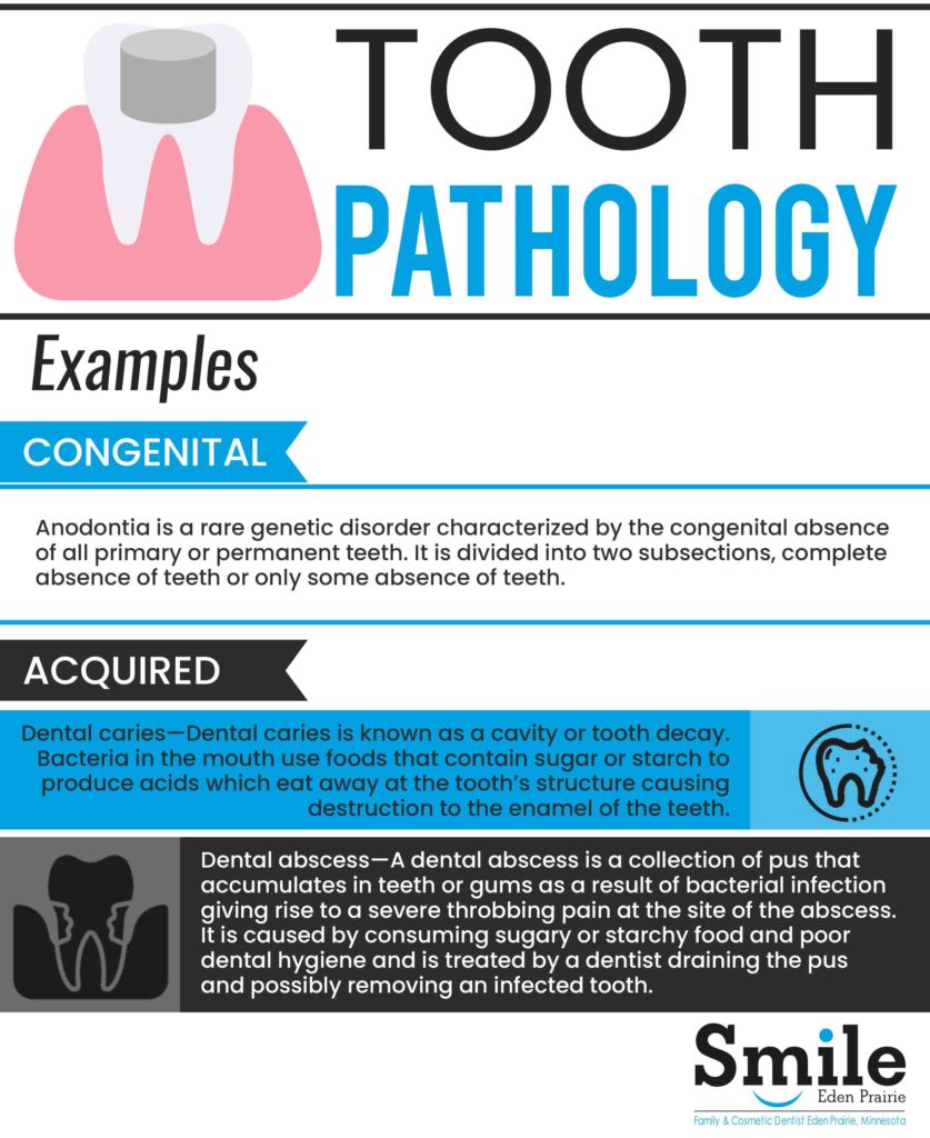 Branches of Dentistry Oral Pathology | Smile Eden Prairie